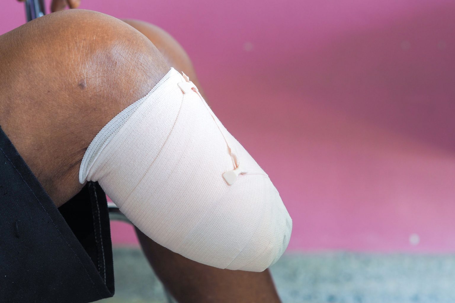 Liability for Florida Amputation Injuries — South Florida Injury Lawyer ...